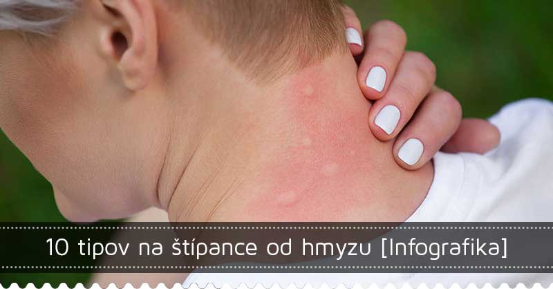 10 tipov na štípance od hmyzu [Infografika] | BIOnatural